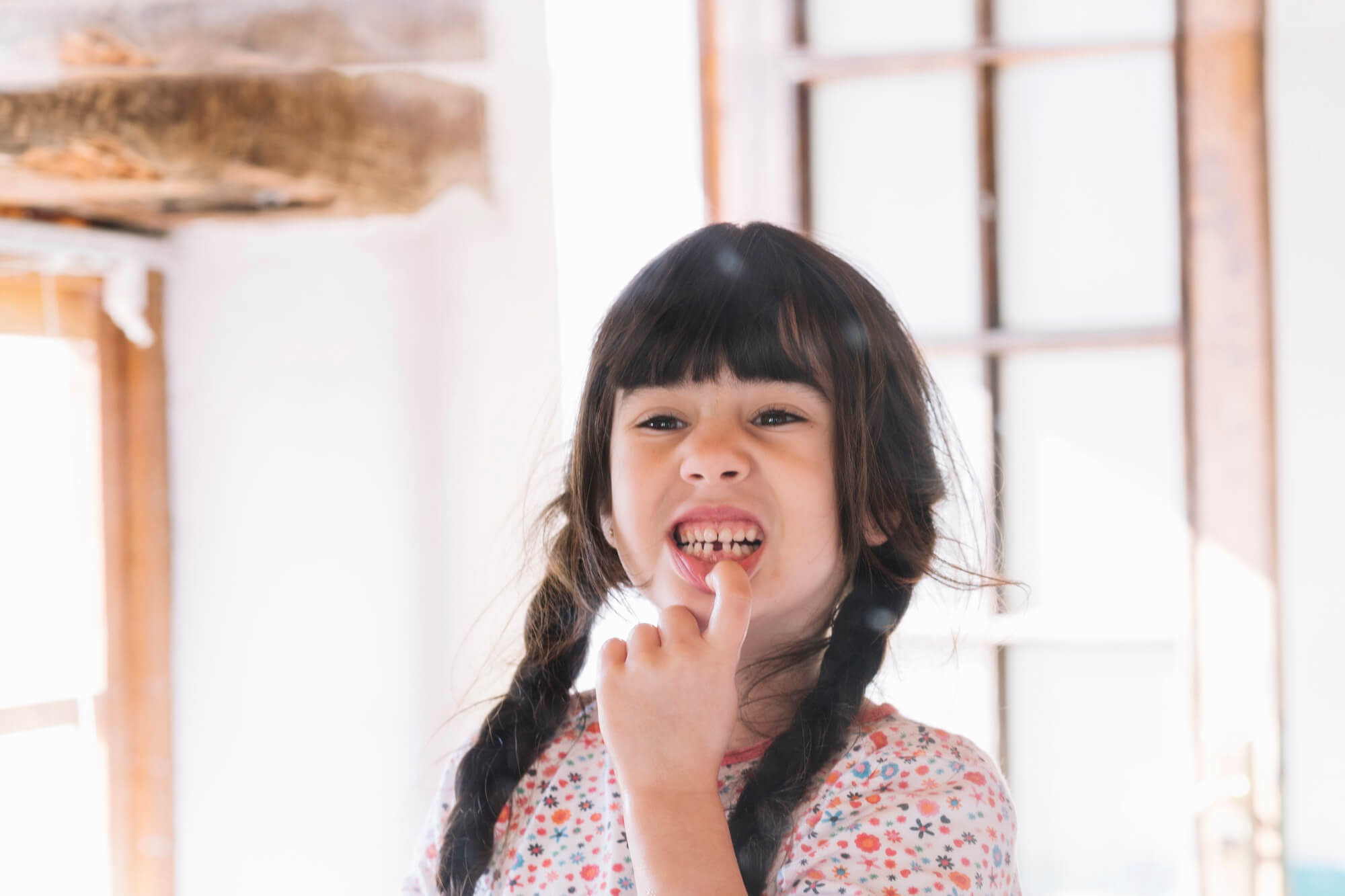 Broken Tooth | Chipped Tooth | Pearl Dental Group